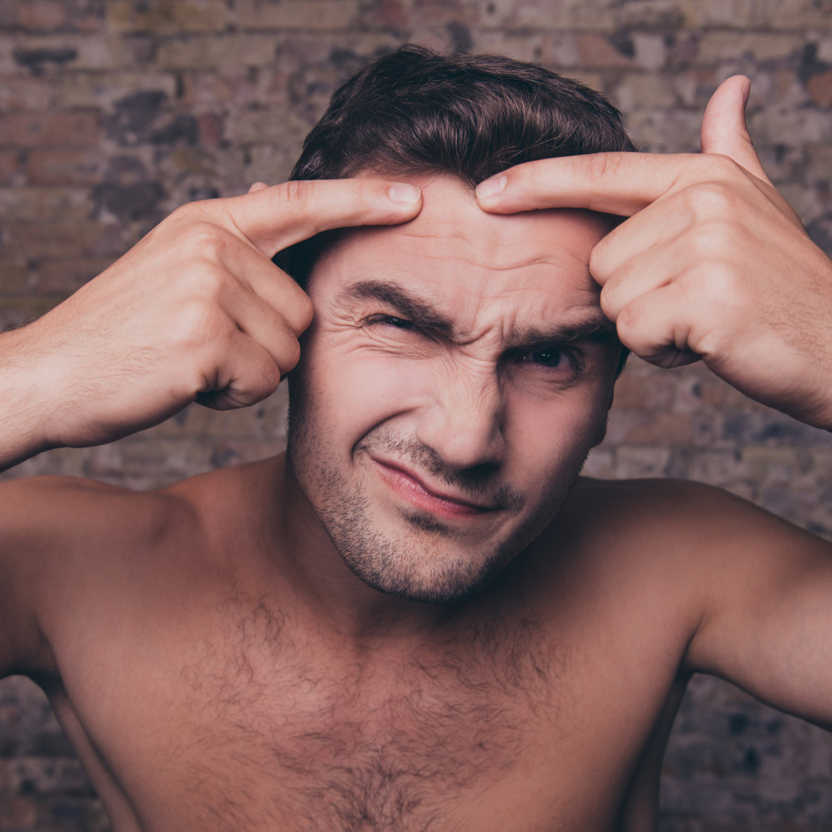 How to Shave When You Have Acne - 6 Helpful Tips – Rocky Mountain ...