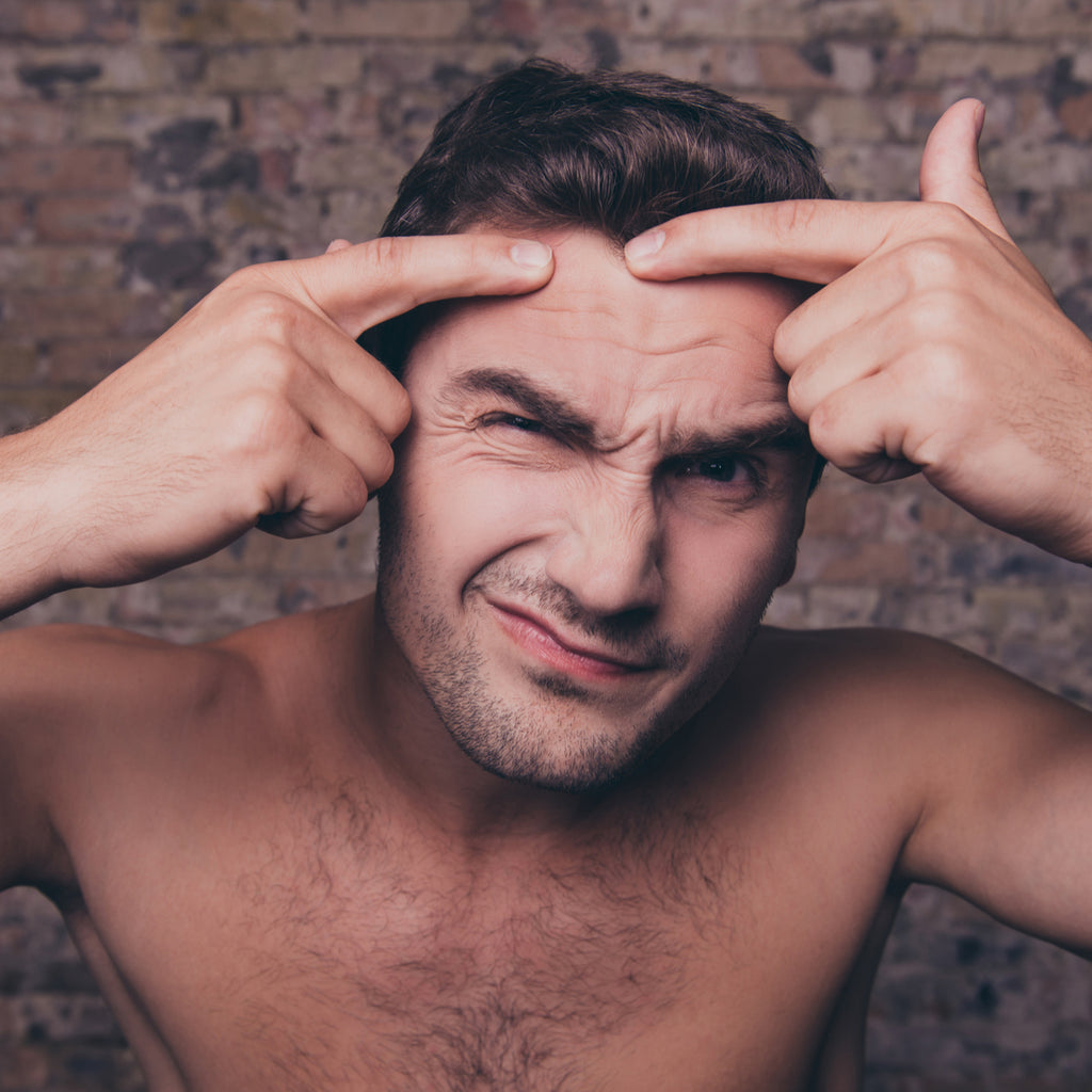 How to Shave When You Have Acne - 6 Helpful Tips – Rocky Mountain ...